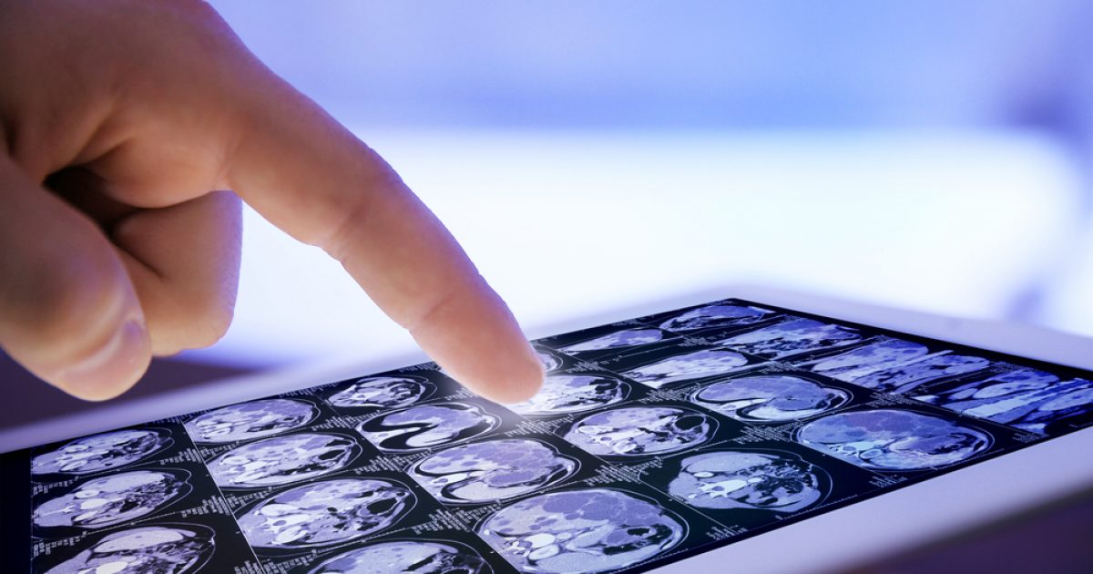 Touchscreens and Infection Control in Healthcare | Microban
